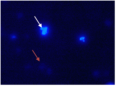 CytoDet Hoechst 33258 染色液 – 艾科瑞生物